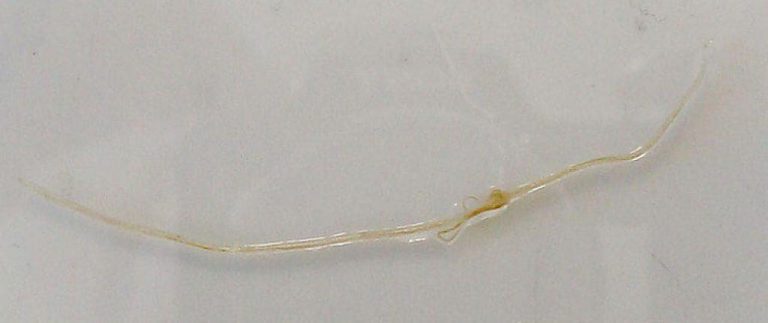 Dangerous Parasites In Humans - Historic Mysteries