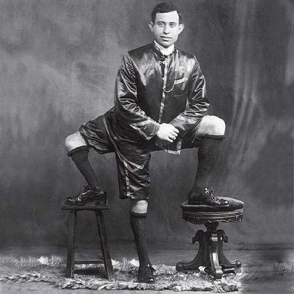 Frank Lentini: Three Legged Man and Circus Superstar - Historic Mysteries