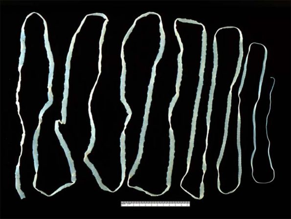 The Victorian Tapeworm Diet: Be The Host With The Most - Historic Mysteries